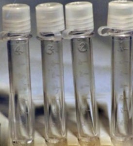 Cerebral Spinal Fluid Analysis... Variations with Age