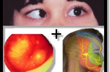 Urinary Retention in Kids — Pediatric EM Morsels