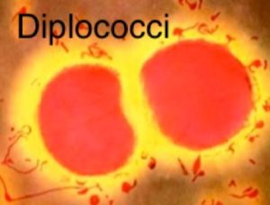 Haemophilus influenzae type b Meningitis Archives — Pediatric EM Morsels