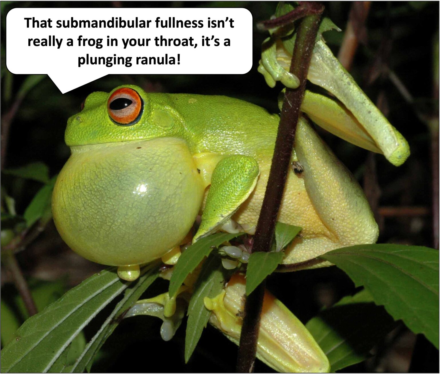 Plunging Ranula — Pediatric EM Morsels